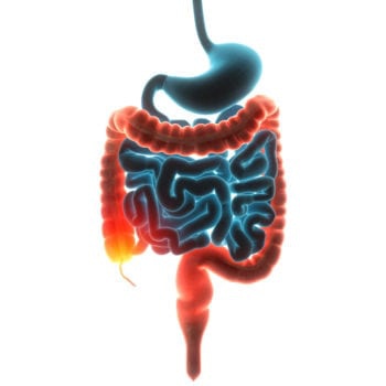 9 Warning Signs & Symptoms Of Leaky Gut
